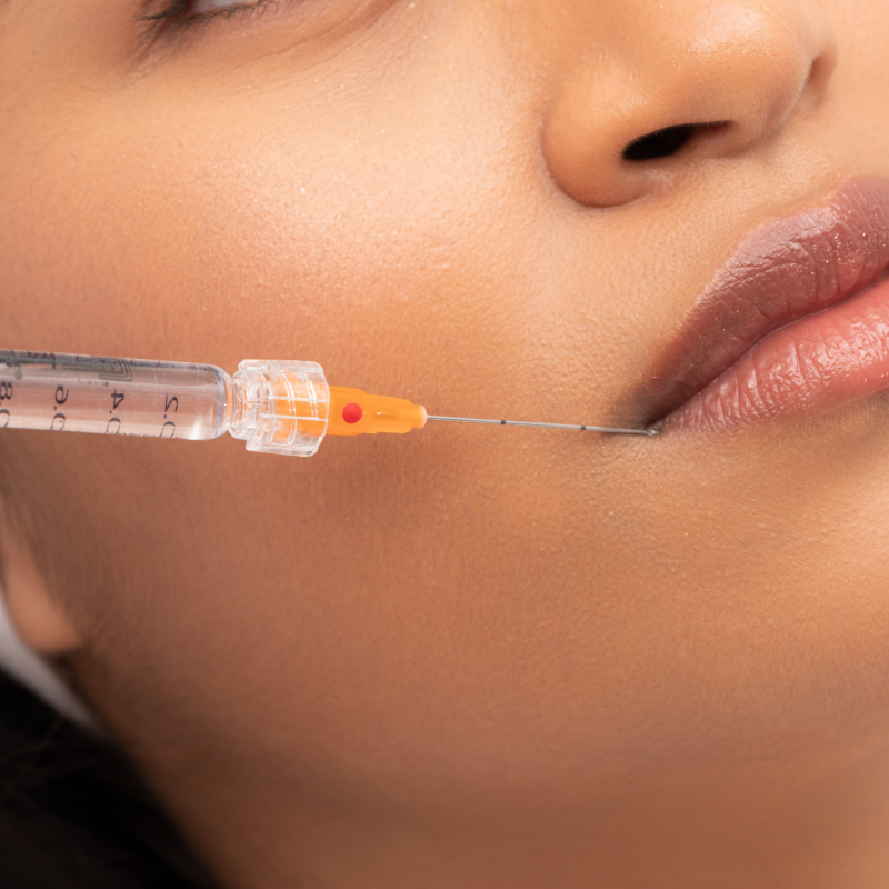 SoftFil® Precision | Face and Body Blunt Tip Microcannula